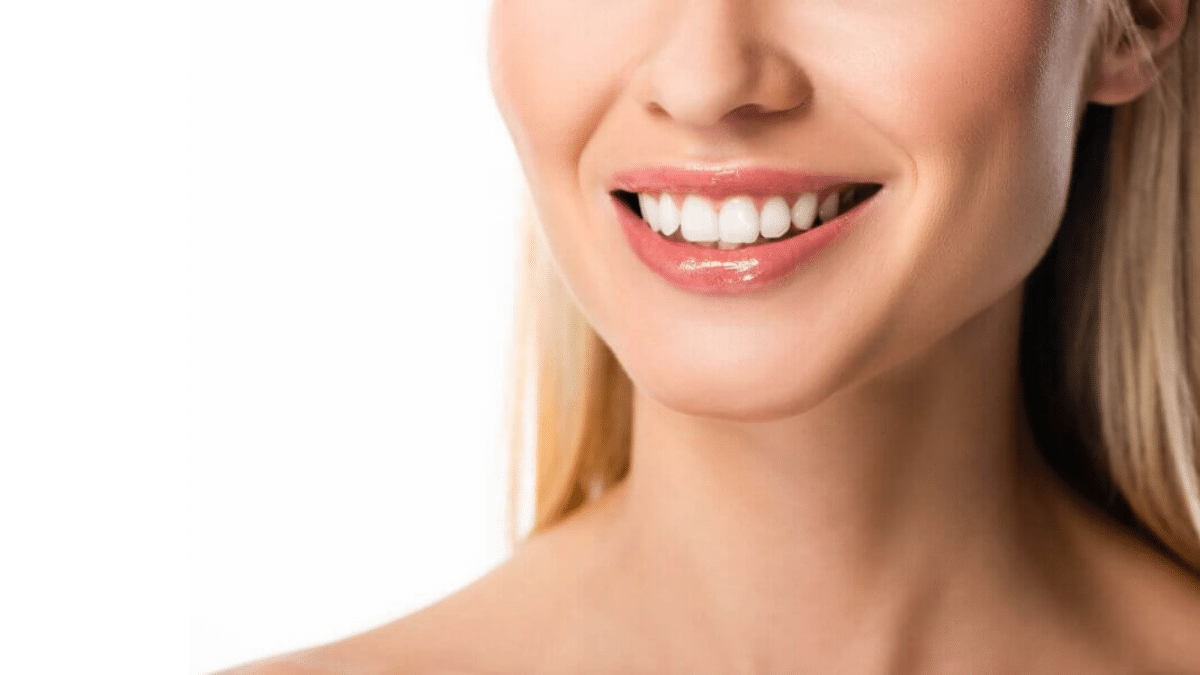 Teeth veneers in Turkey : what is the average cost